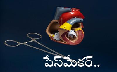 పేస్‌మేకర్ హార్ట్ పేషెంట్లకు ఎప్పుడు అవసరం..? - What heart conditions ...